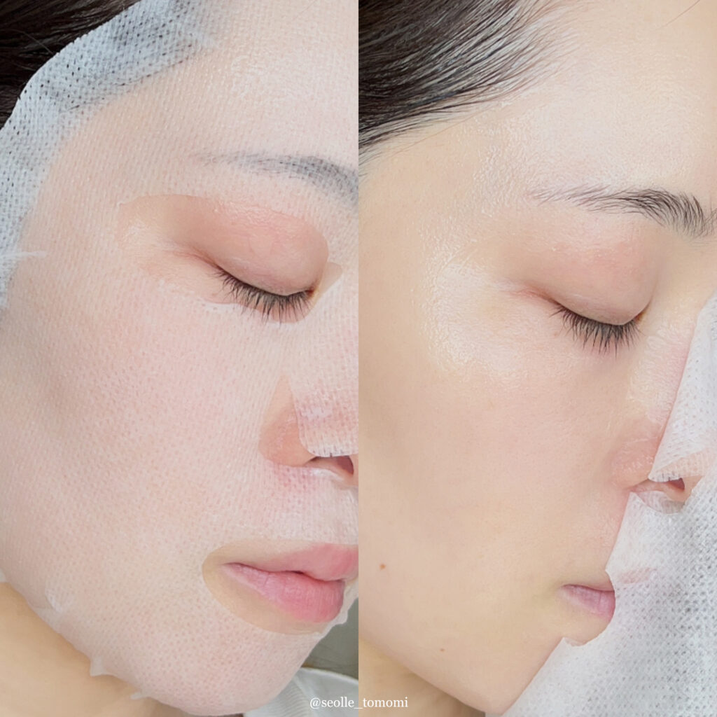 ハリ・弾力のあるお肌へ！イージーデュー「DW-EGFシリーズ」「フィルアップヴォリュームスポット」をレビュー｜tomomiの美容ブログ